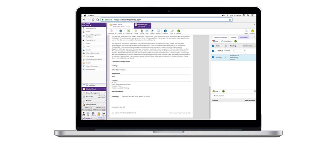 gGastro EHR Software, Endoscopy Report Writer Software | Free Demo And ...